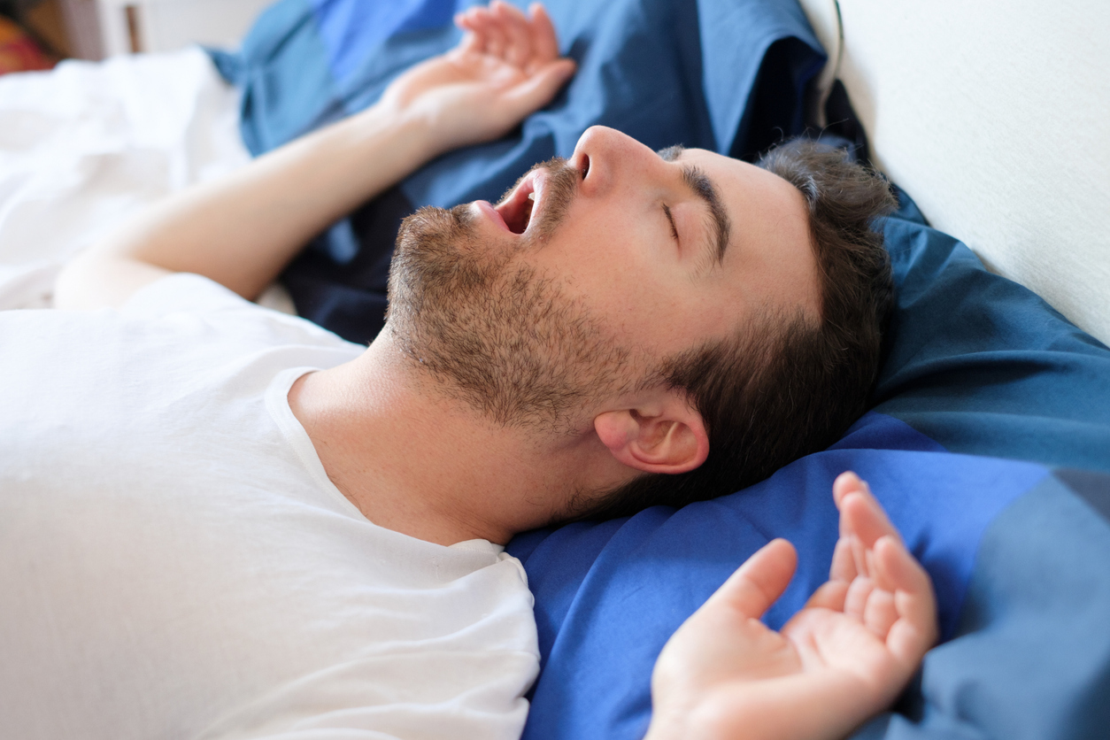 Ronflements et Apnée du sommeil - SleepDoctor