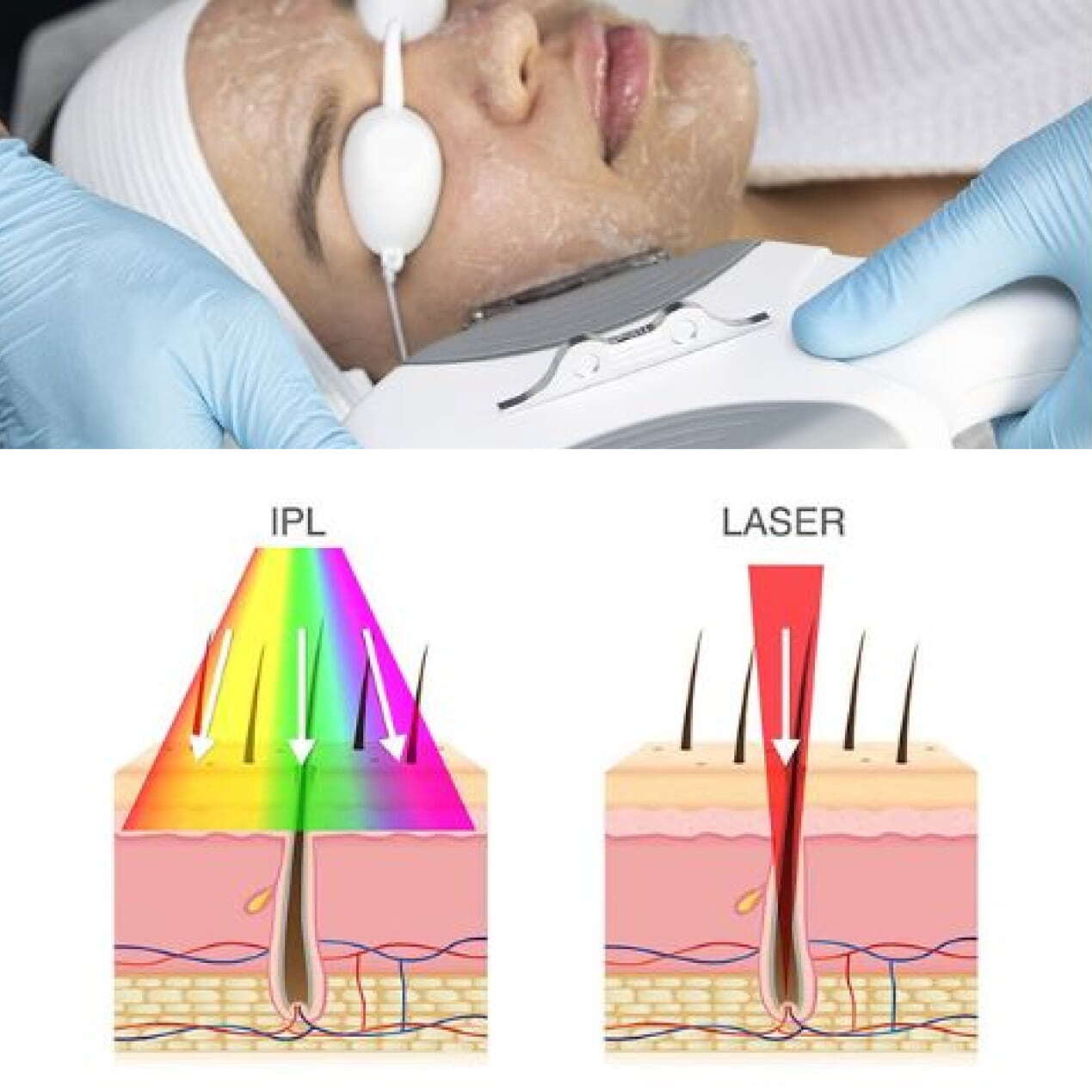 IPL Laser Machine ZEMITS Light Expert 2.0 | Esthetic Spa Equipment for sale