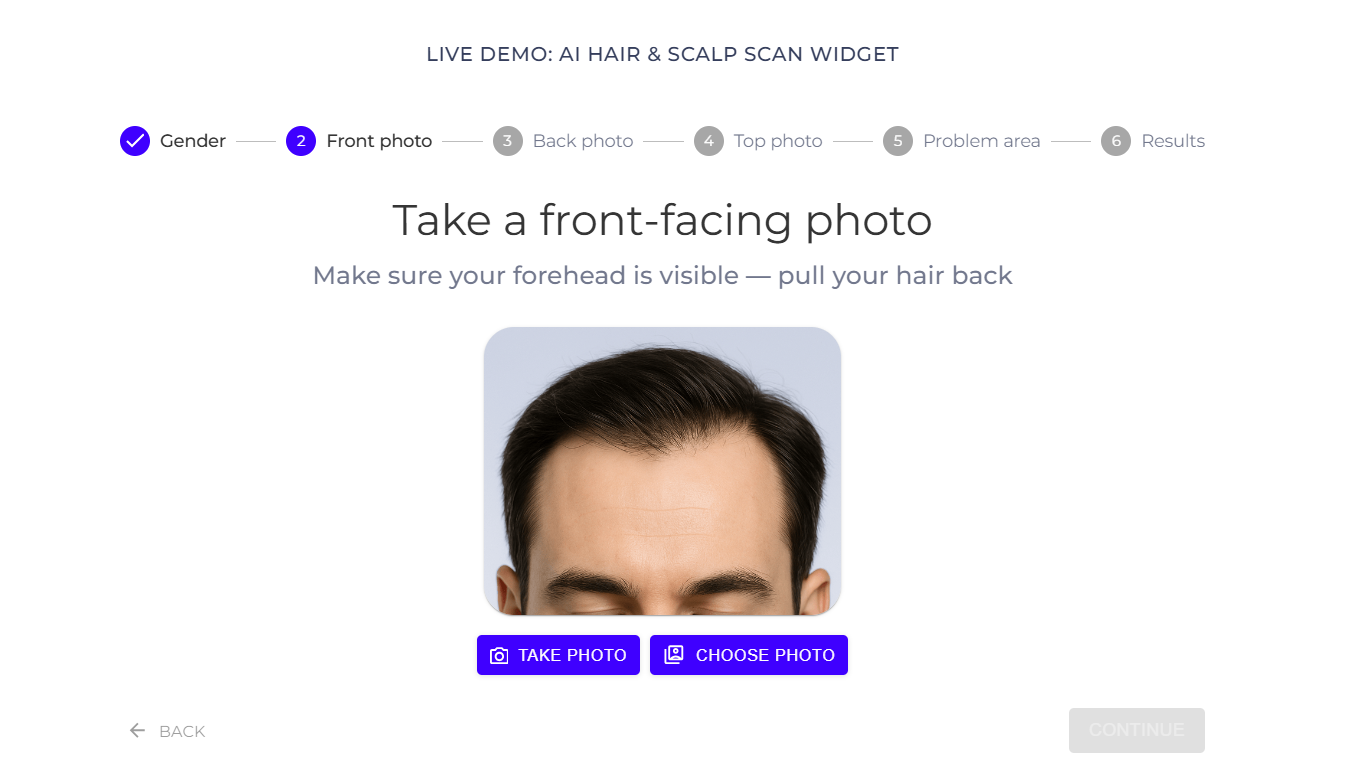 White-label Hair AI Diagnostic Widgets | iHairium