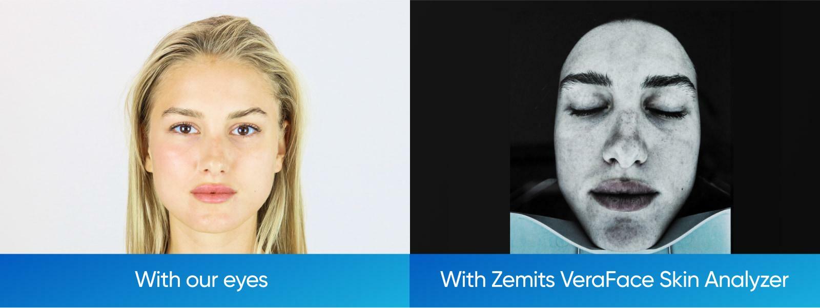 Zemits VeraFace Skin Analyzer Professional Skin Analysis System ...