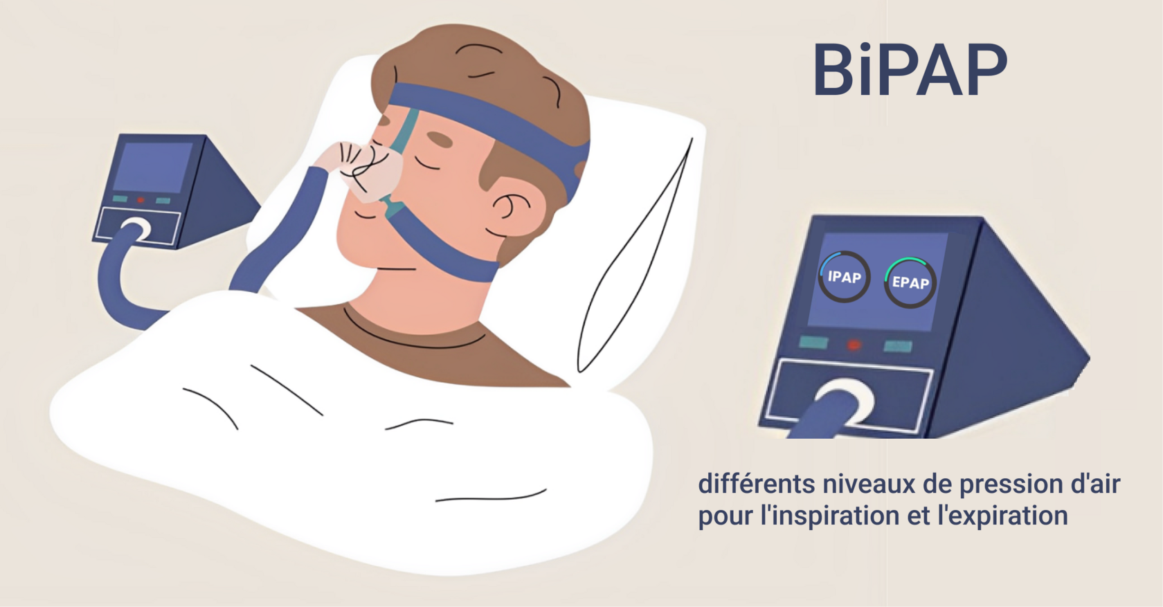 La ventilation BiPAP pour traiter l’apnée du sommeil