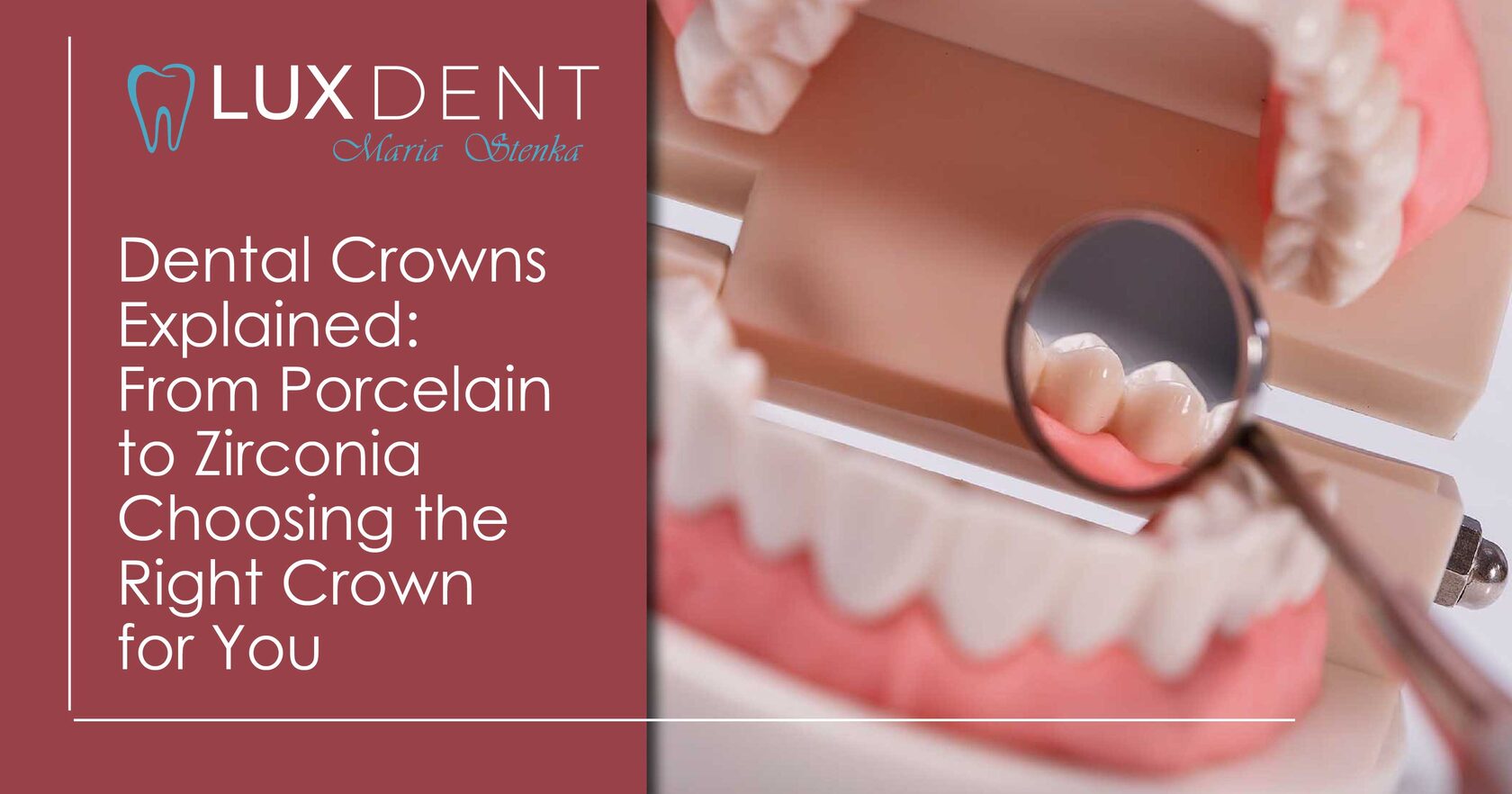 Dental Crowns Explained: From Porcelain to Zirconia - Choosing the Right Crown for You