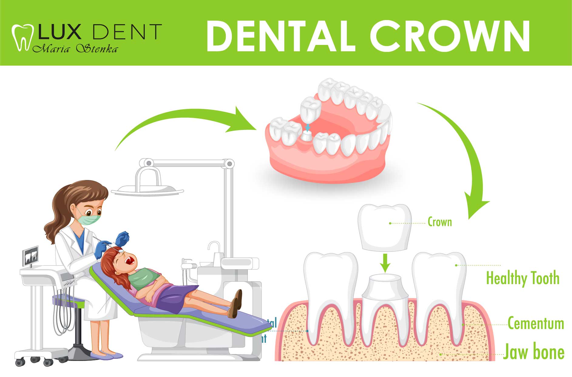 Dental Crowns Explained: From Porcelain to Zirconia - Choosing the Right Crown for You