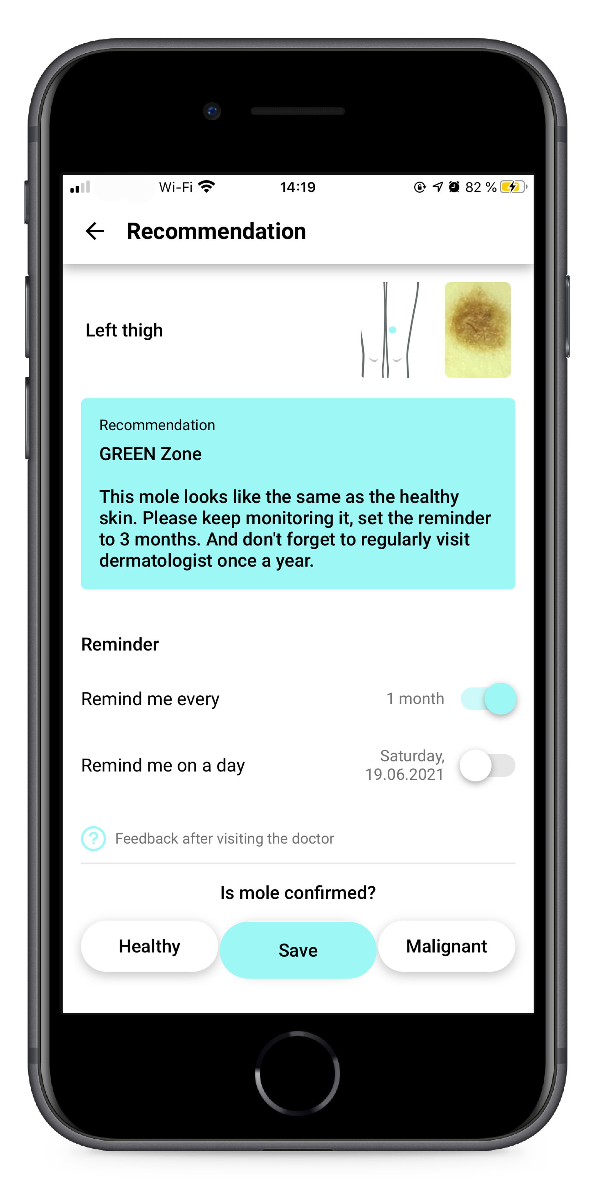 NOTA - best mole tracker for diagnosis skin cancer at home. Buy for ...