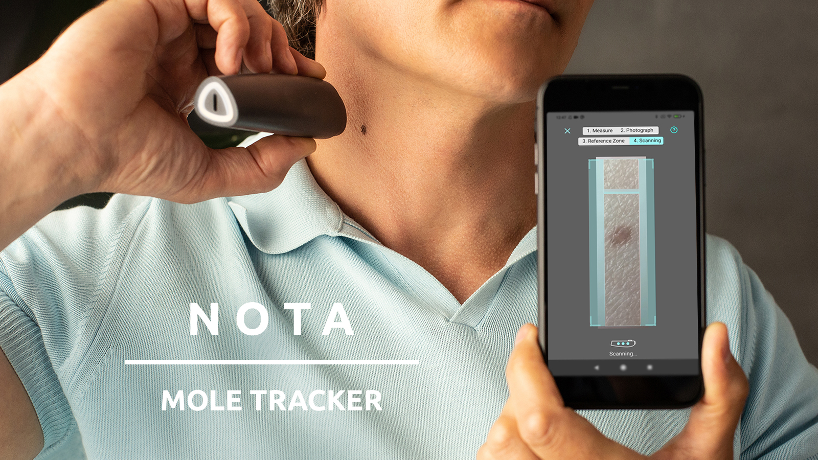 NOTA - best mole tracker for diagnosis skin cancer at home. Buy for ...