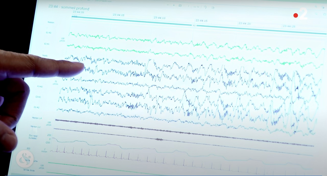 Polysomnographie : explorez votre sommeil