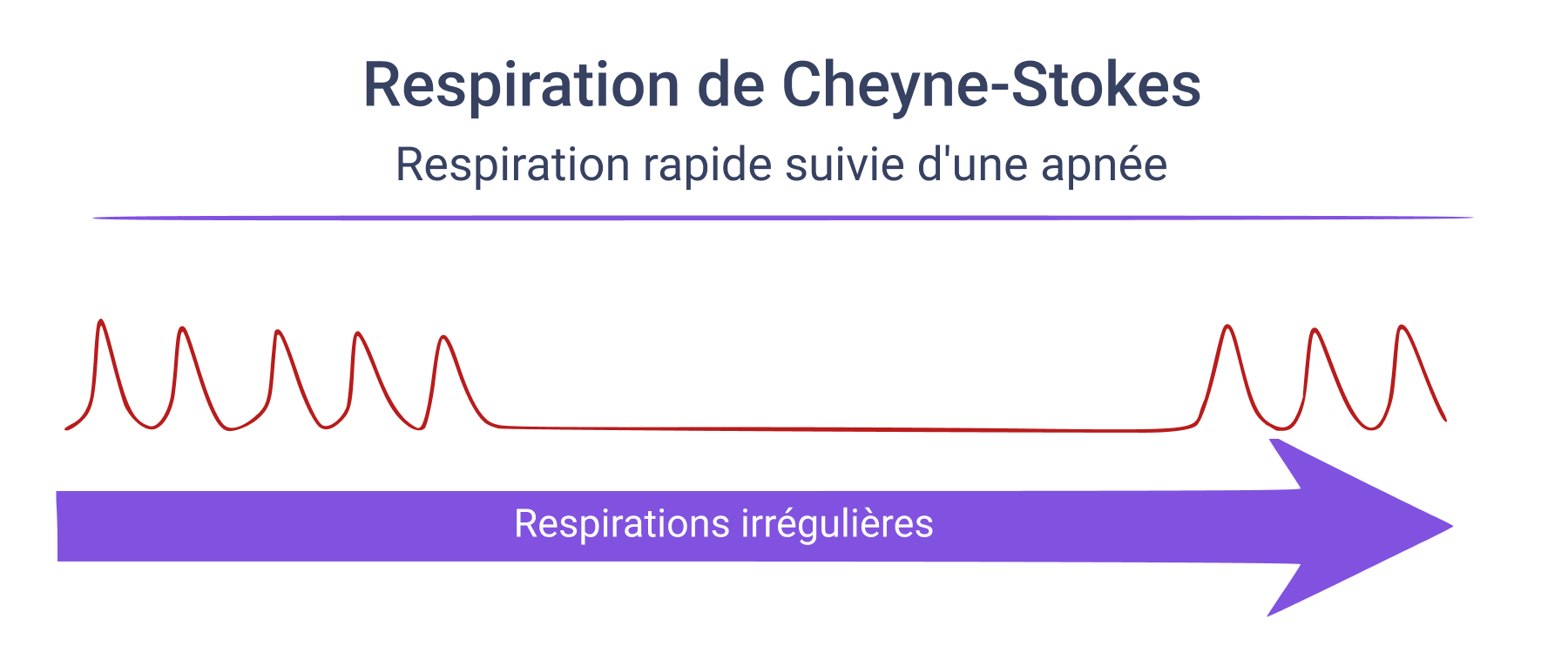 Respiration de Cheyne-Stokes