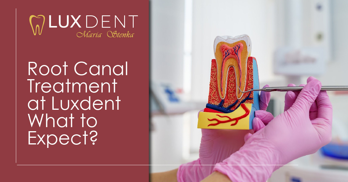 Root Canal Treatment at Luxdent What to Expect?
