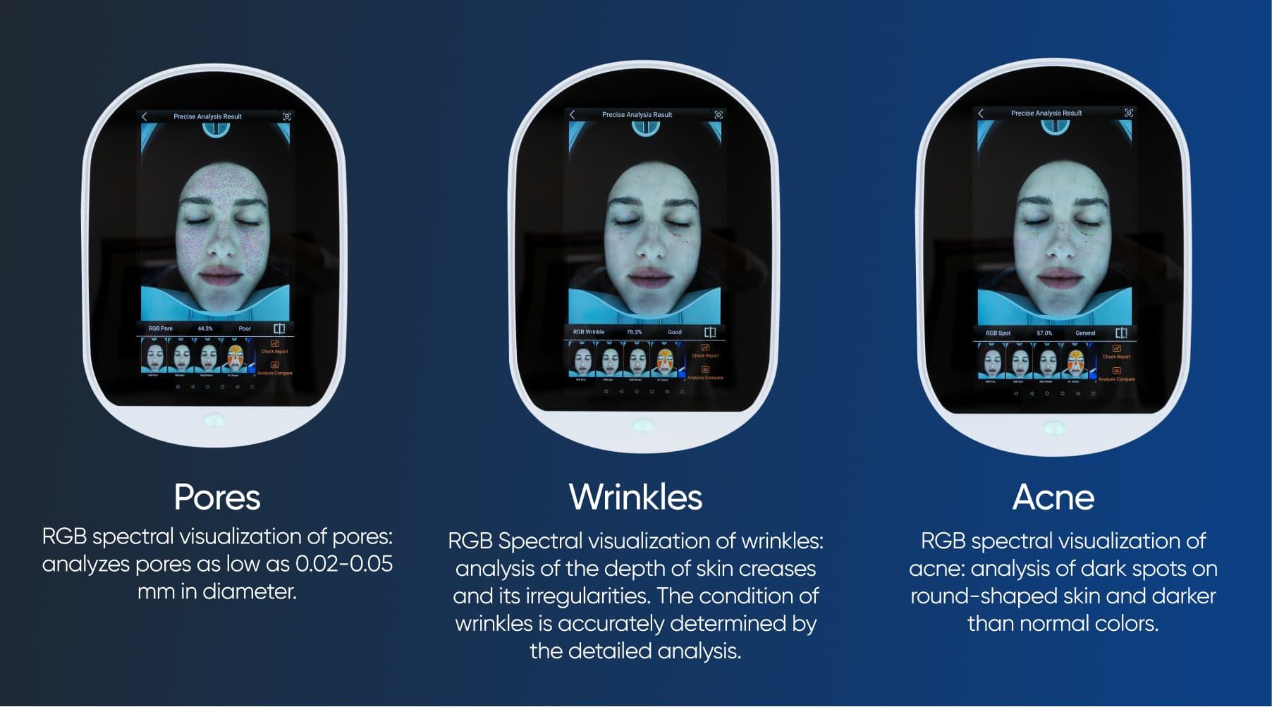 Zemits VeraFace Skin Analyzer Professional Skin Analysis System ...