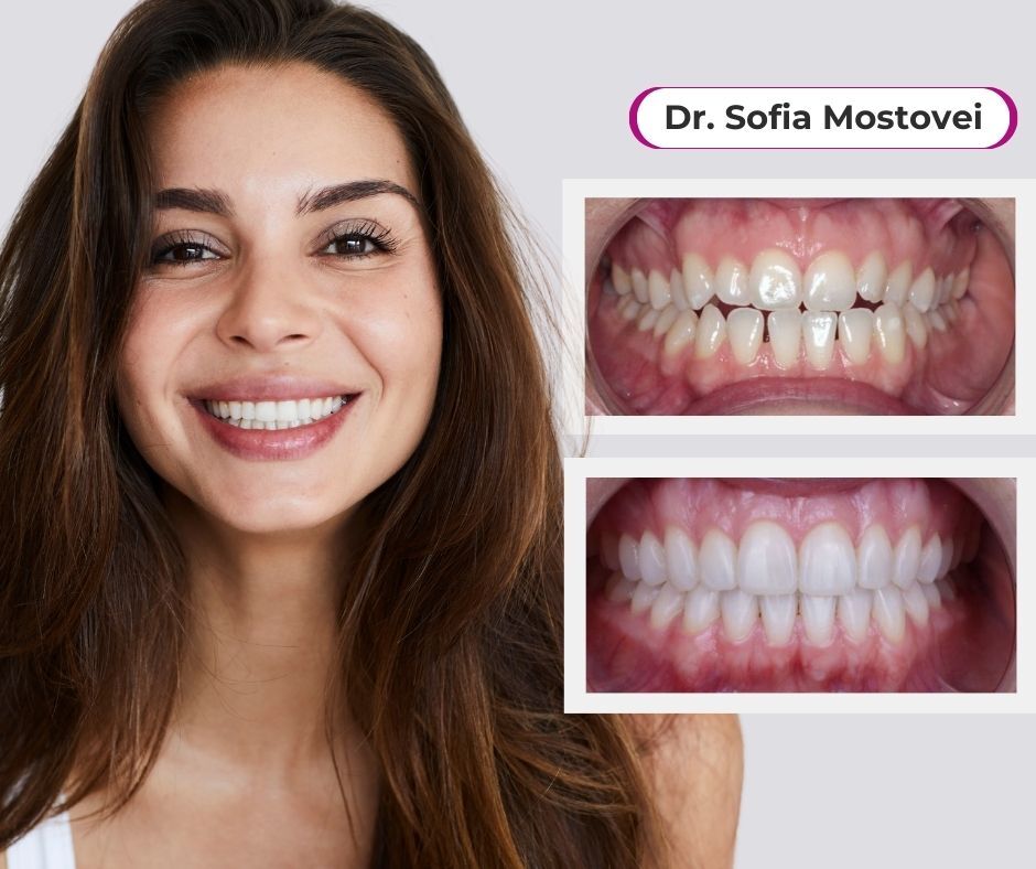 Dr. Sofia Mostovei - Brackets Pret Chisinau
