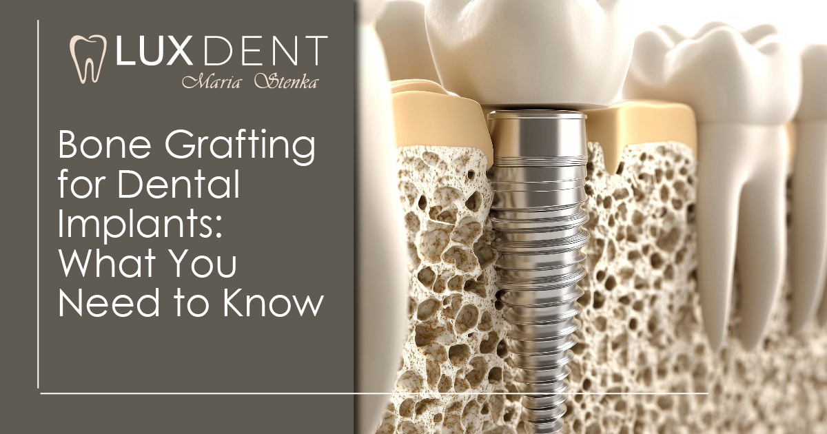 Bone Grafting for Dental Implants: What You Need to Know