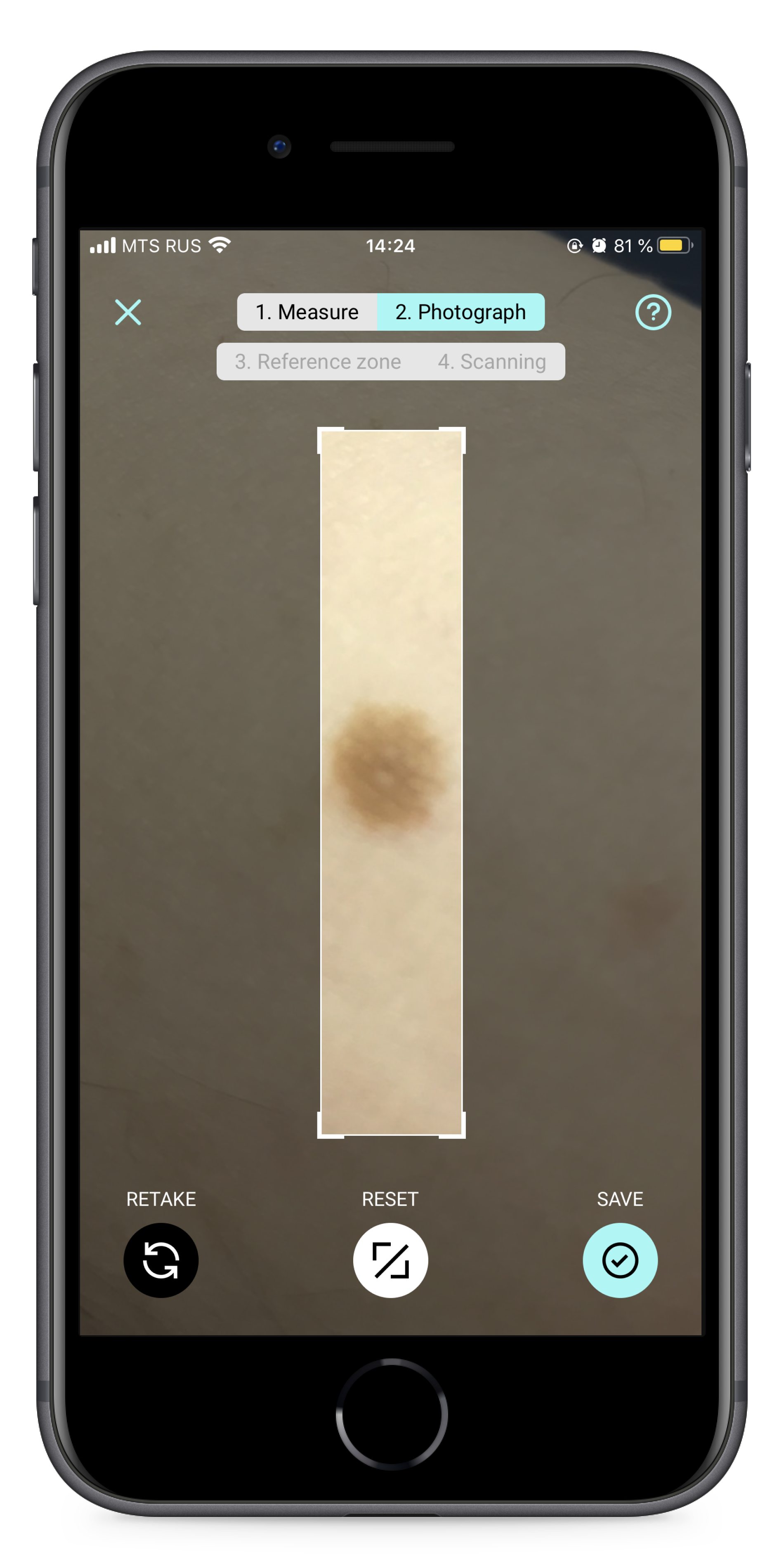 NOTA - best mole tracker for diagnosis skin cancer at home. Buy for ...